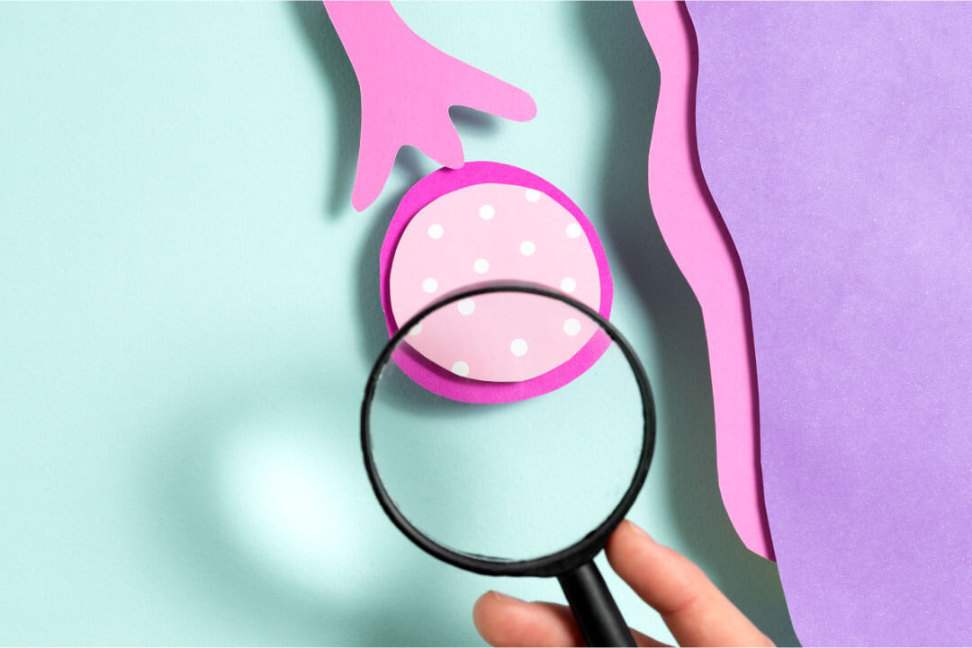 Reverse Your Pcos Symptoms Naturally 4 Ways To Improve Womens Health